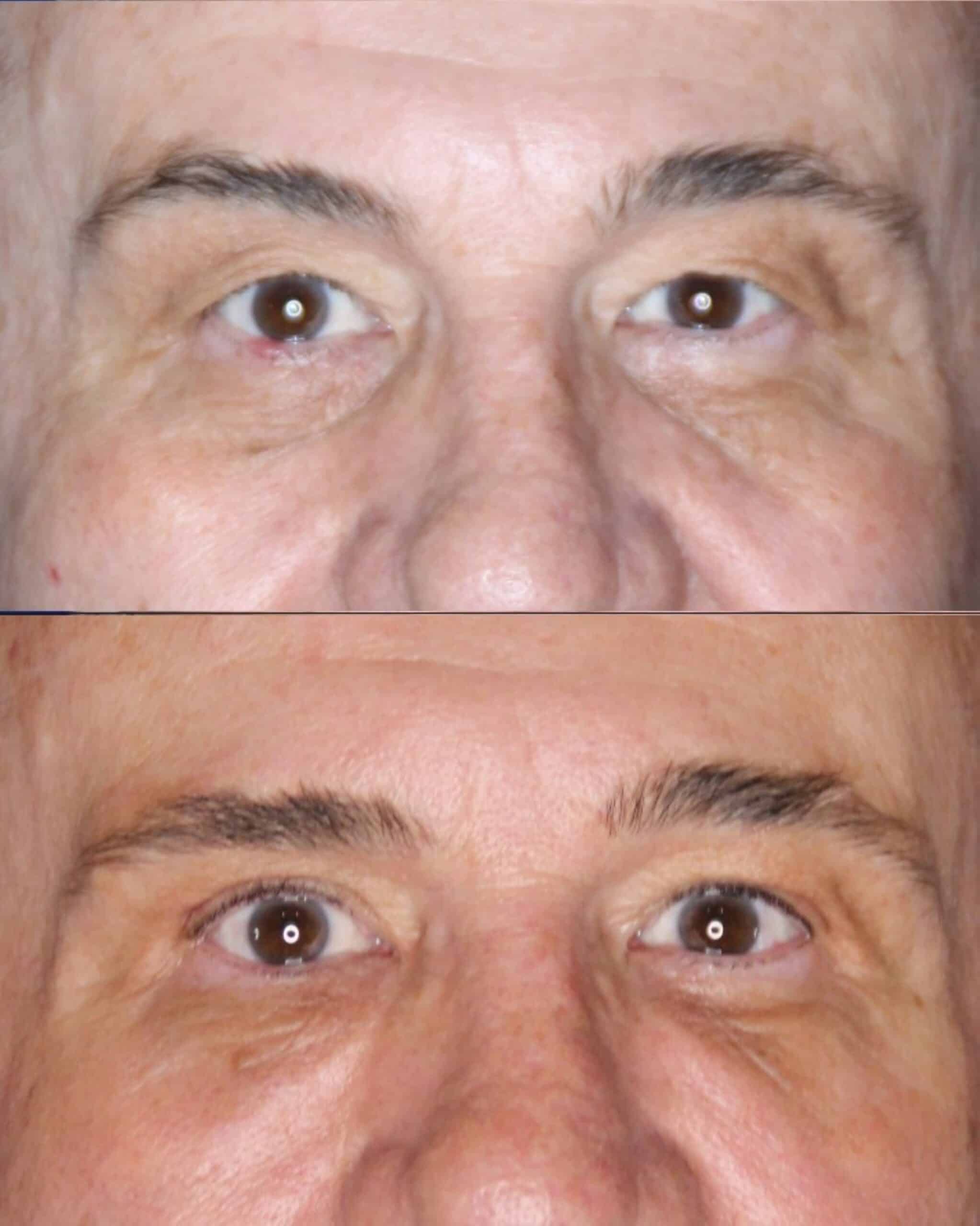 Ear Surgery Case Gallery